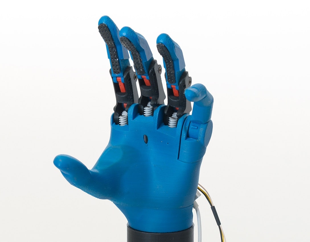 Modulare Handprothese aus dem 3D-Drucker